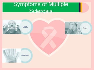 Awareness about Multiple Sclerosis | PPT