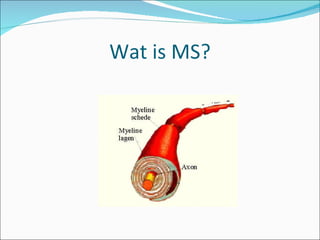 Multiple sclerose | PPT