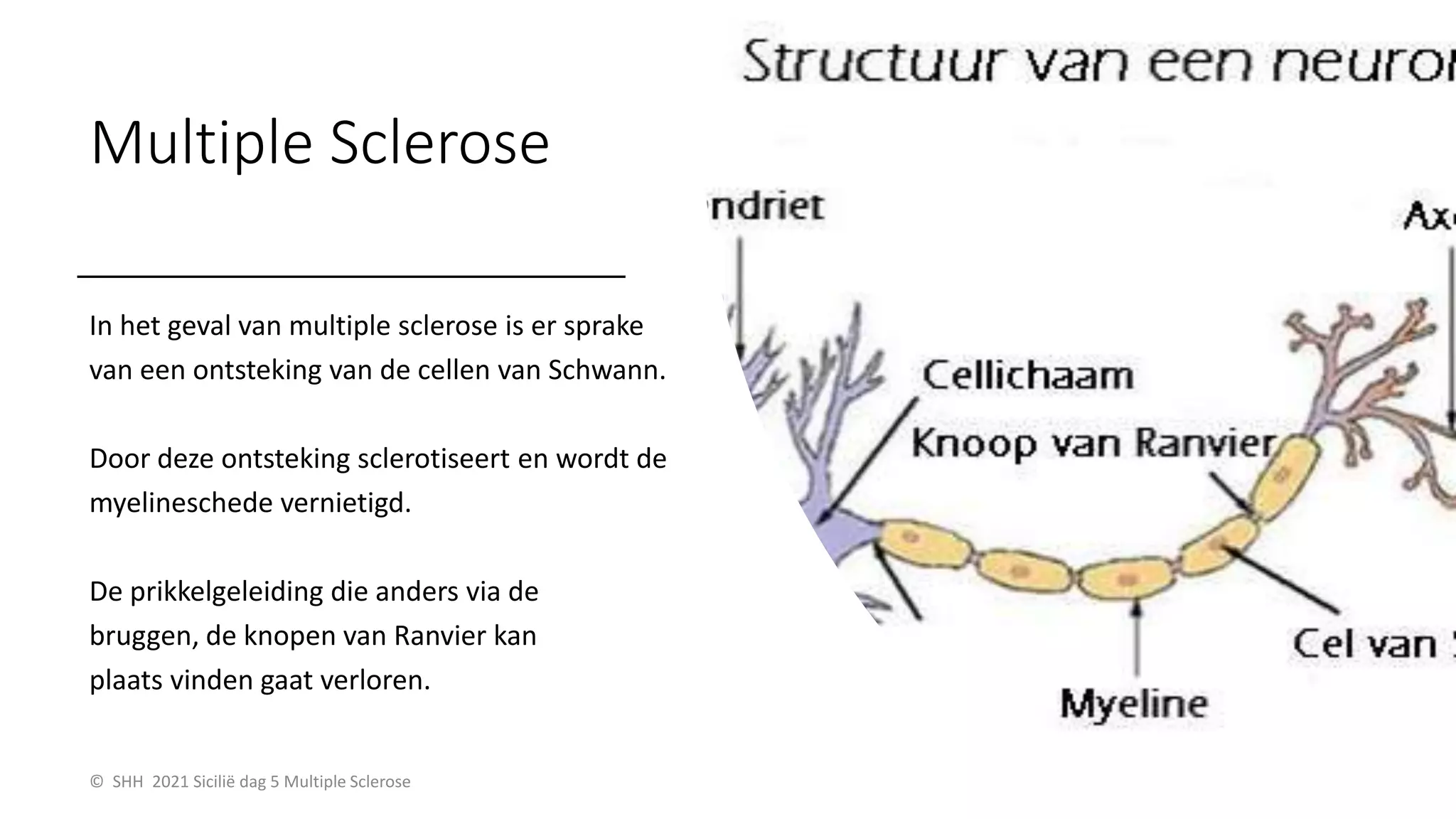 Multiple Sclerose | PPTX