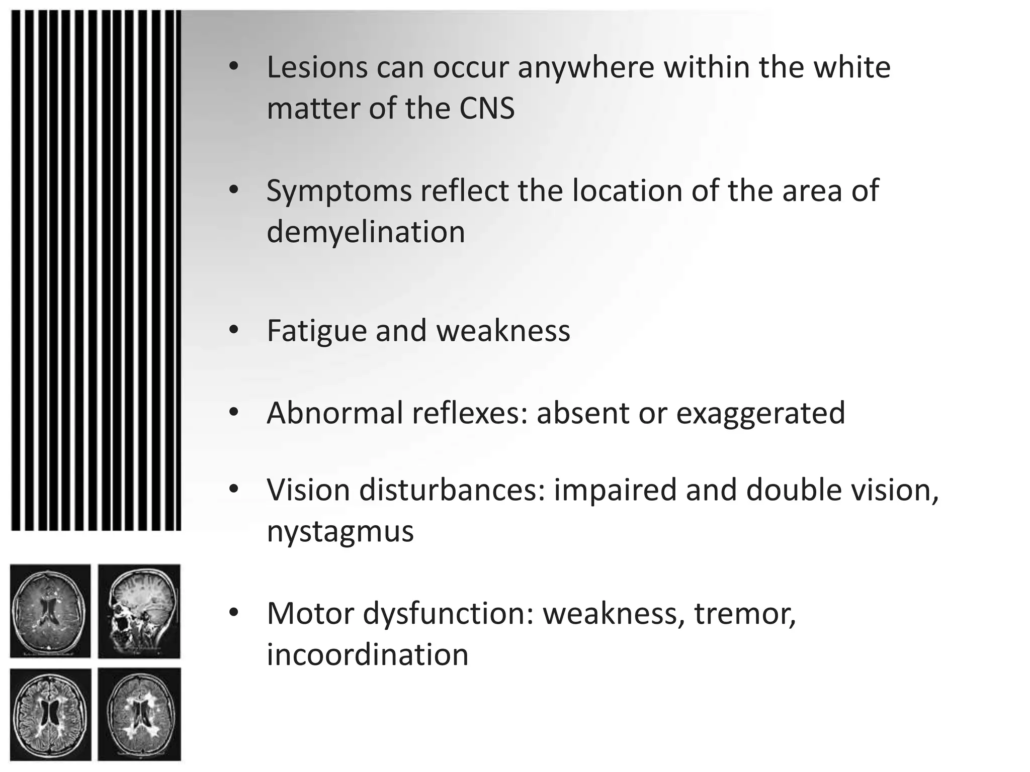 Multiple sclerosis: Medical and Nursing Managements | PPTX
