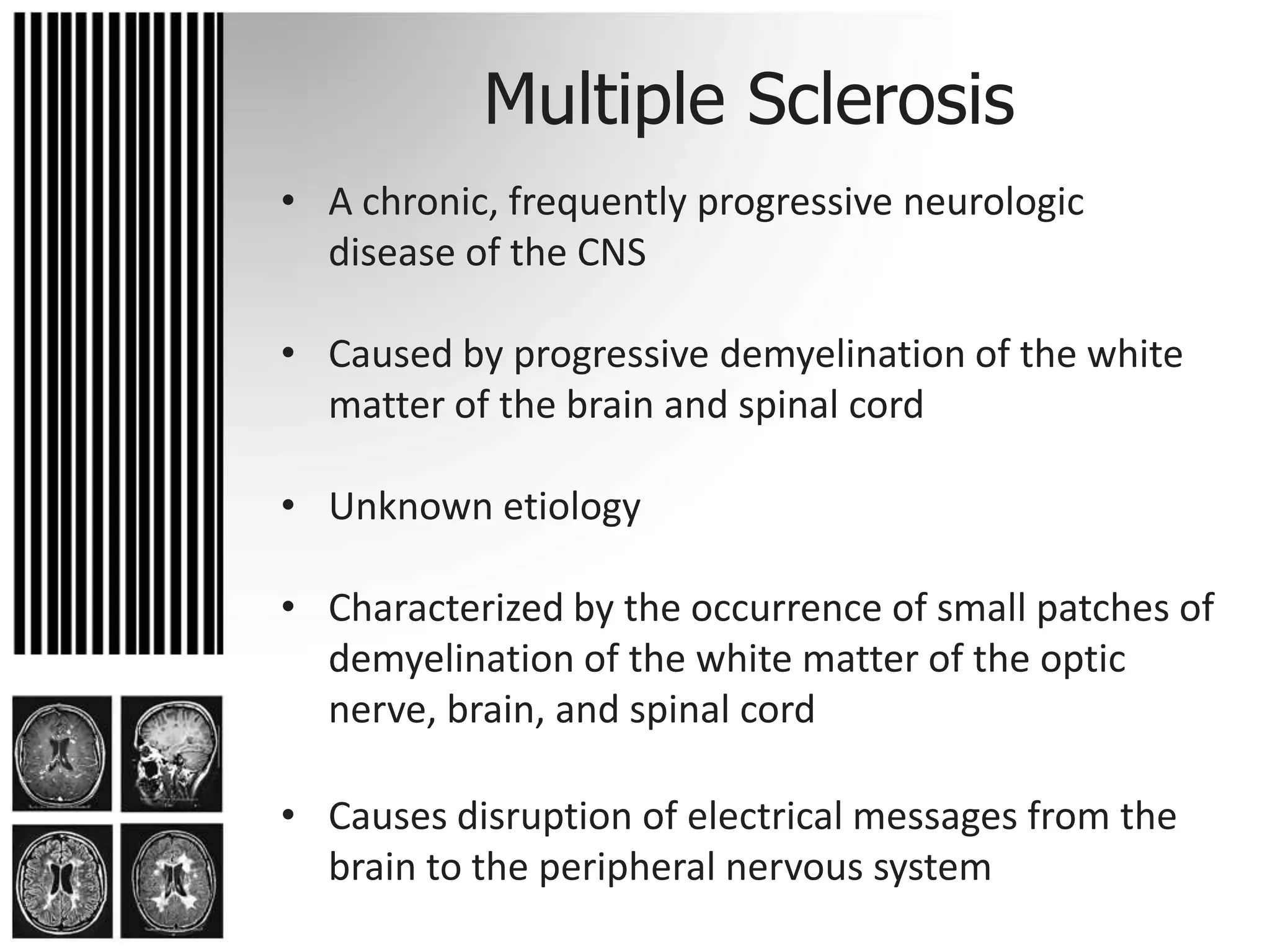 Multiple sclerosis: Medical and Nursing Managements | PPTX