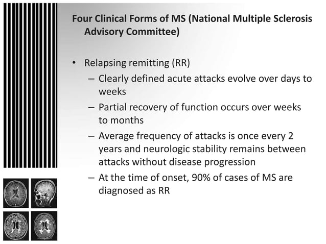 Multiple sclerosis: Medical and Nursing Managements | PPTX | Brain and Nervous System Disorders ...