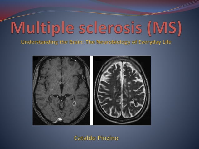 Multiple sclerosis | PPT