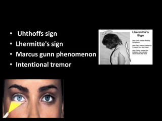 Multiple sclerosis | PPT