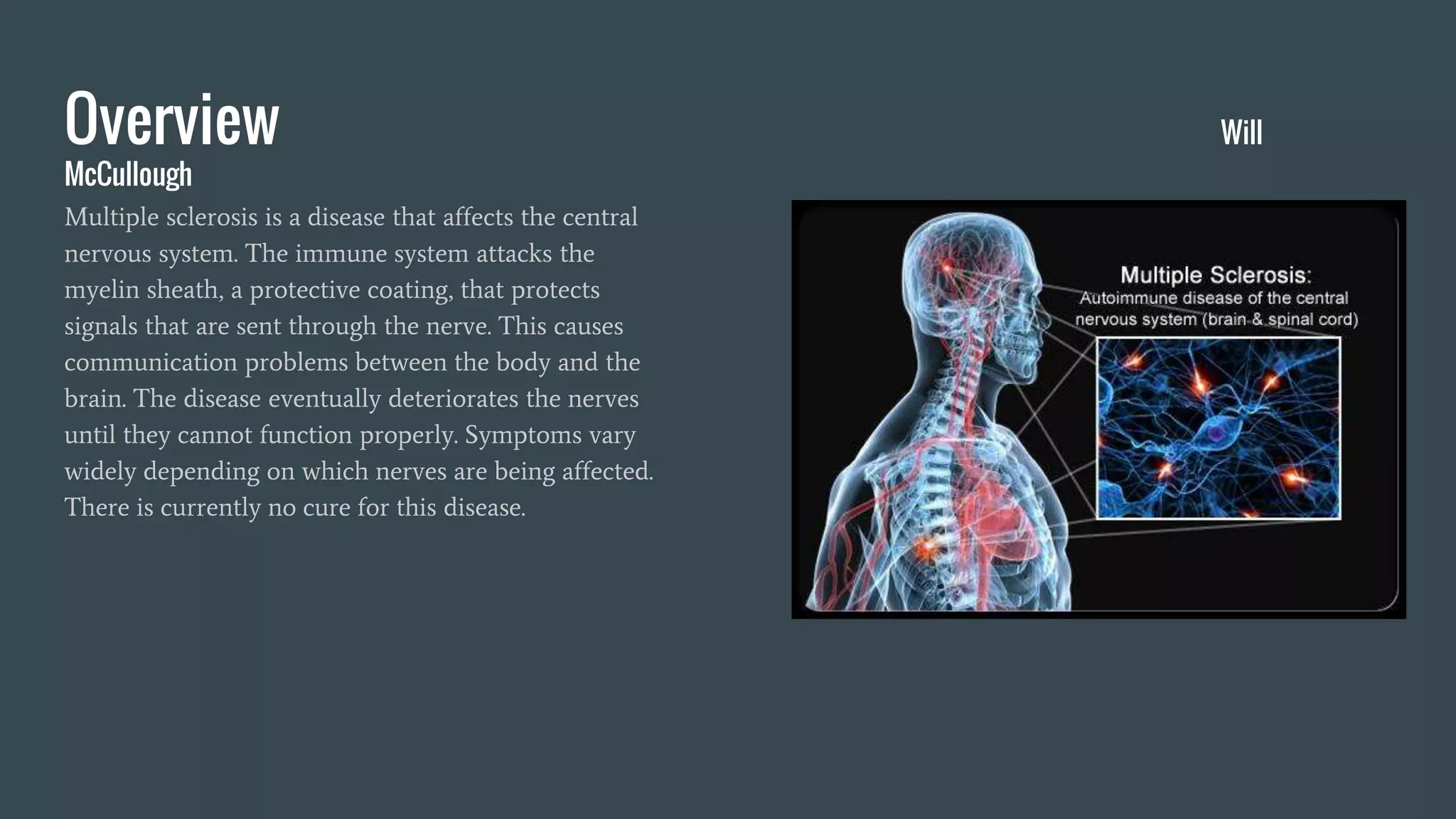 Multiple sclerosis | PPT