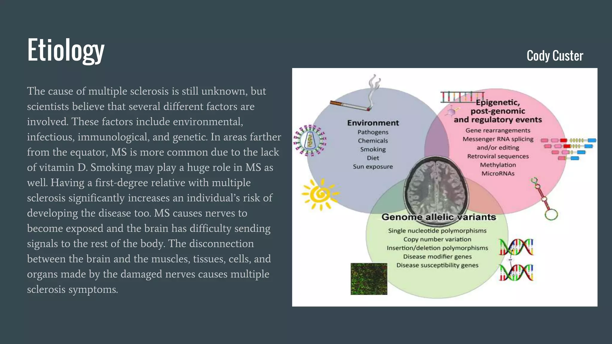 Multiple sclerosis | PPTX