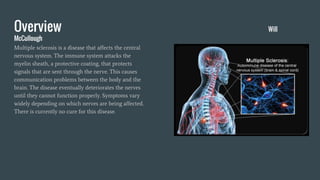 Multiple sclerosis | PPT