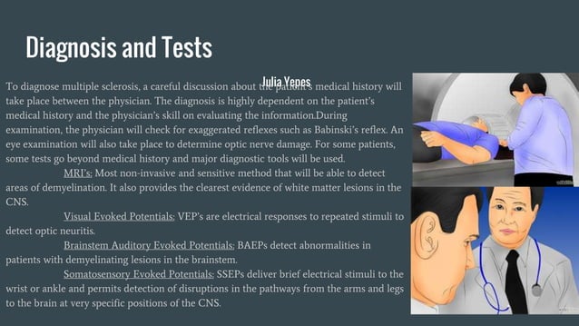 Multiple sclerosis | PPT