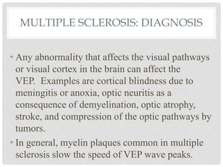 Multiple sclerosis | PPTX