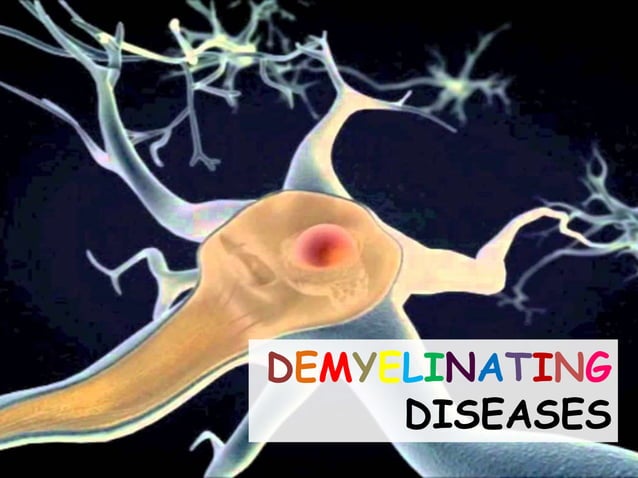 Demyelinating diseases | PPTX
