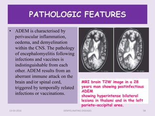 Demyelinating diseases | PPTX