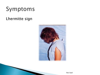 Multiple sclerosis | PPT