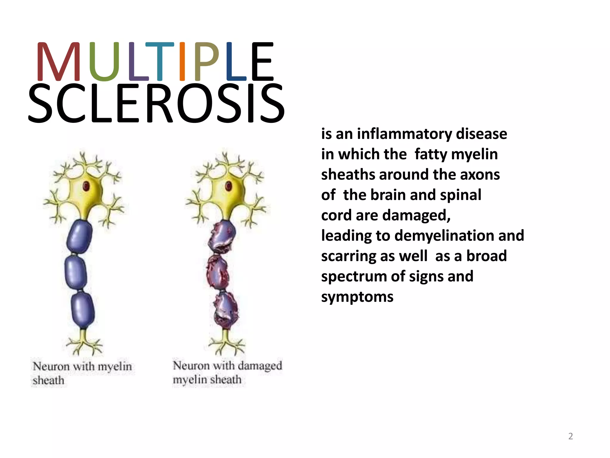 Multiple sclerosis | PPT
