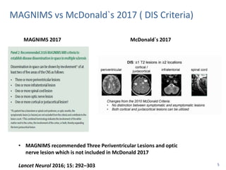Multiple sclerosis: Revised diagnostic criteria | PPTX