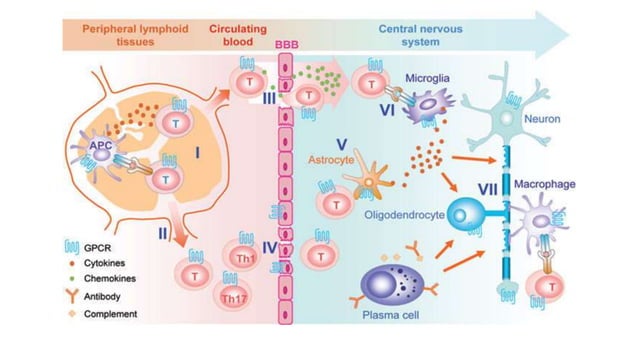 Multiple sclerosis, Types and Treatment | PPT