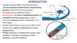 Multiple sclerosis: Introduction, Risk Factors, Diagnosis and Treatment ...