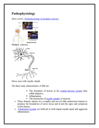 Multiple sclerosis | DOCX