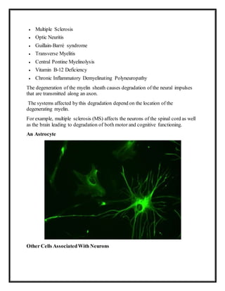 Multiple sclerosis | DOCX