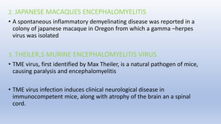 screening model for Multiple sclerosis | PPTX