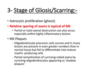 Multiple sclerosis.ppt
