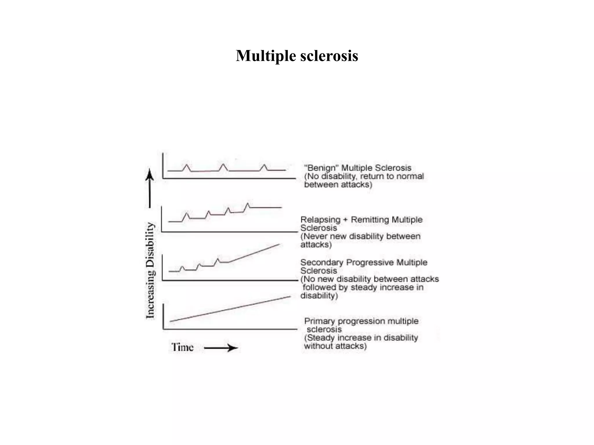 Multiple sclerosis.pdf
