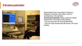 demyelinated disorder: multiple sclerosis.pptx