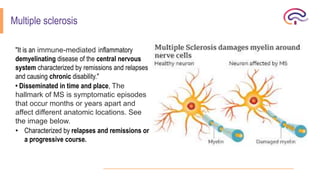 demyelinated disorder: multiple sclerosis.pptx