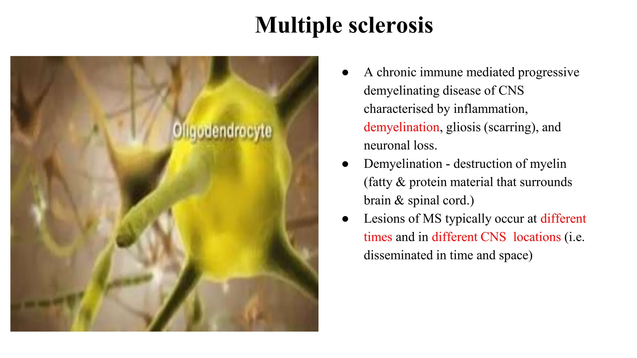 Multiple sclerosis (Demyelinating disease).pptx