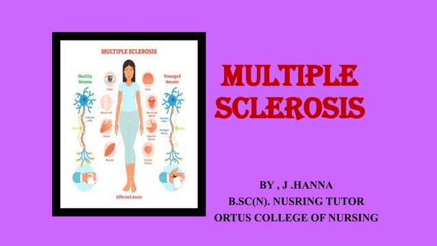 Multiple sclerosis( neurological disorders) | PPTX