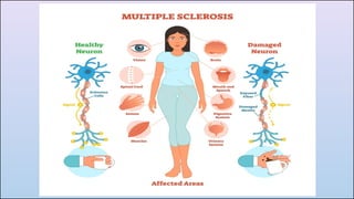 MULTIPLE SCLEROSIS(M.PHARM PHARMACOLOGY).pptx