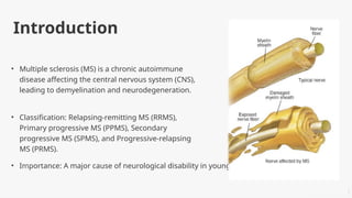 Multiple Sclerosis. why and how it occurs ? | PPT