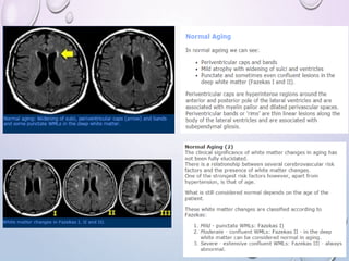 Imaging in Multiple sclerosis | PPTX