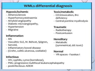 Imaging in Multiple sclerosis | PPTX