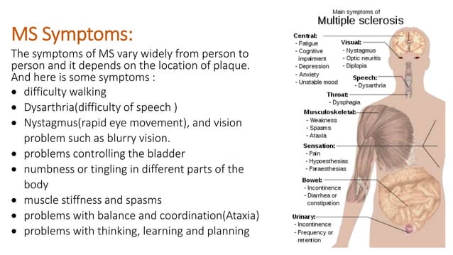 Multiple sclerosis pathophysiology, diagnosis, and treatment | PPTX