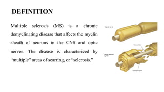multiple sclerosis_063233.pptx