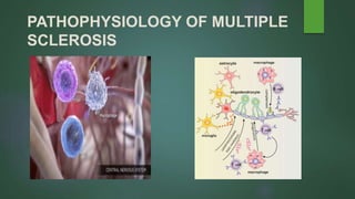 Multiple Sclerosis | PPT