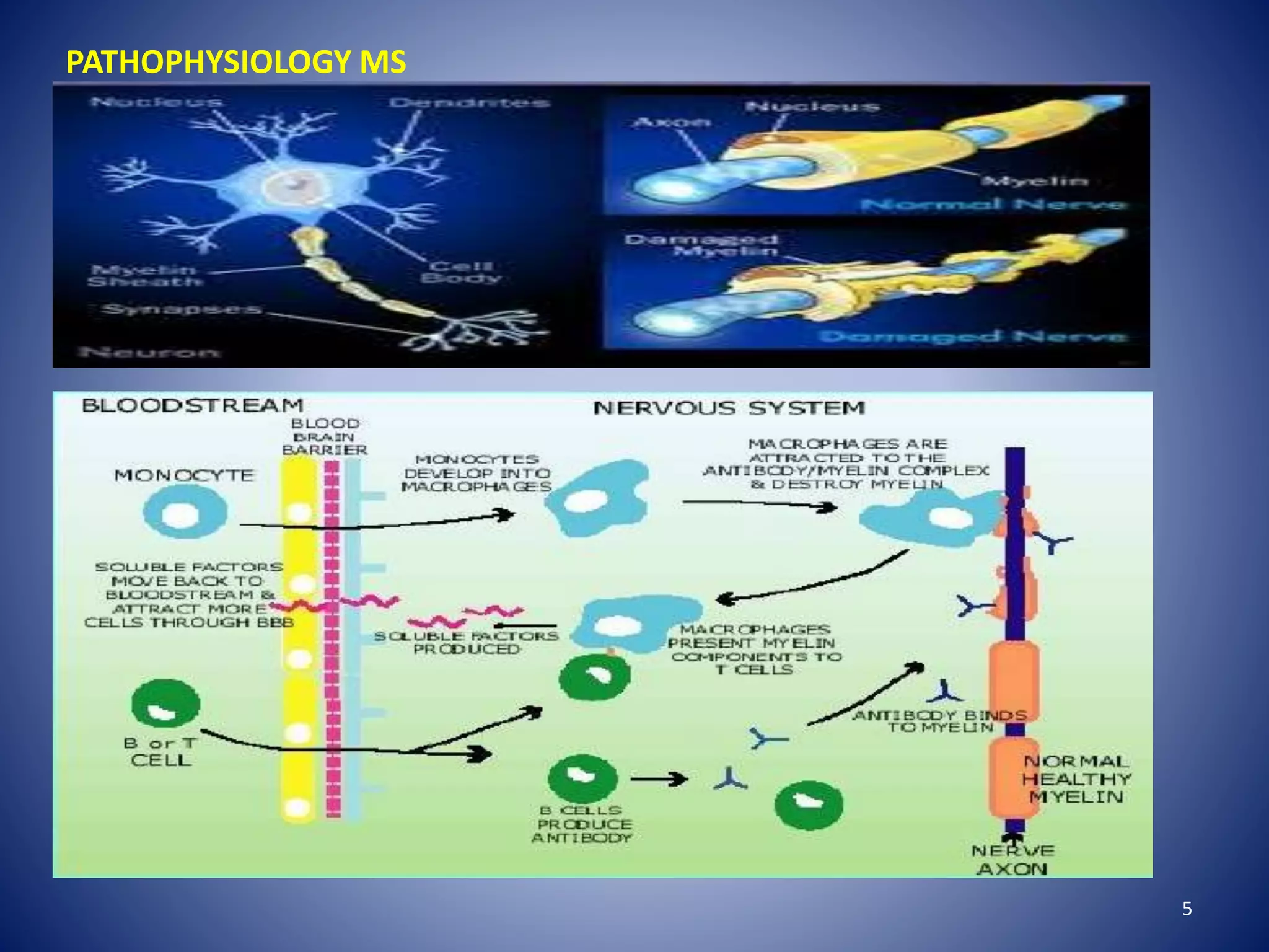 Multiple sclerosis screening methods | PPTX