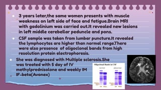 MULTIPLE SCLEROSIS (1).pdf