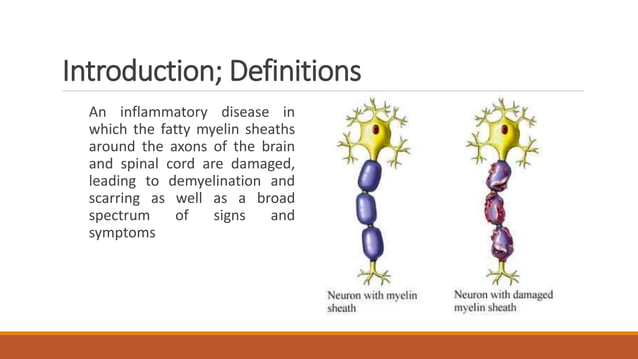 MULTIPLE_SCLEROSIS_ (1).pptx trrhggfrffghhv | PPTX