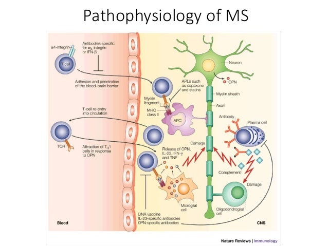 Multiple sclerosis by Dr. Basil B. Tumaini