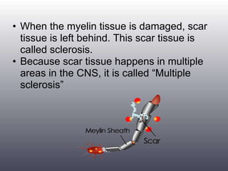 Multiple sclerosis (bio3800) | PPTX