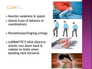 Multiple sclerosis | PPTX