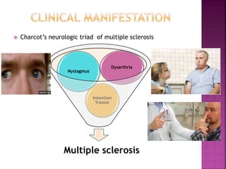 Multiple sclerosis | PPT