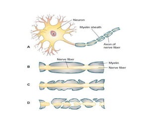 Multiple sclerosis (ms) | PPTX | Physical Therapy | Wellness