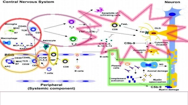 Multiple sclerosis, pathogenesis | PPTX | Brain and Nervous System ...