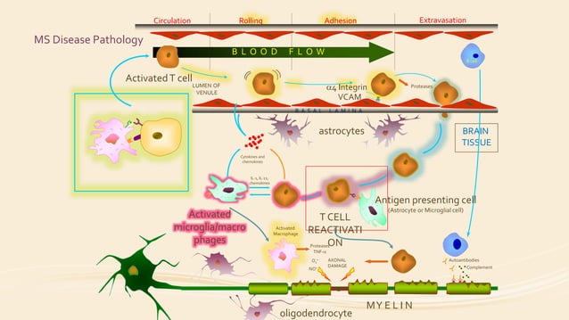 Multiple sclerosis, pathogenesis | PPTX | Brain and Nervous System ...