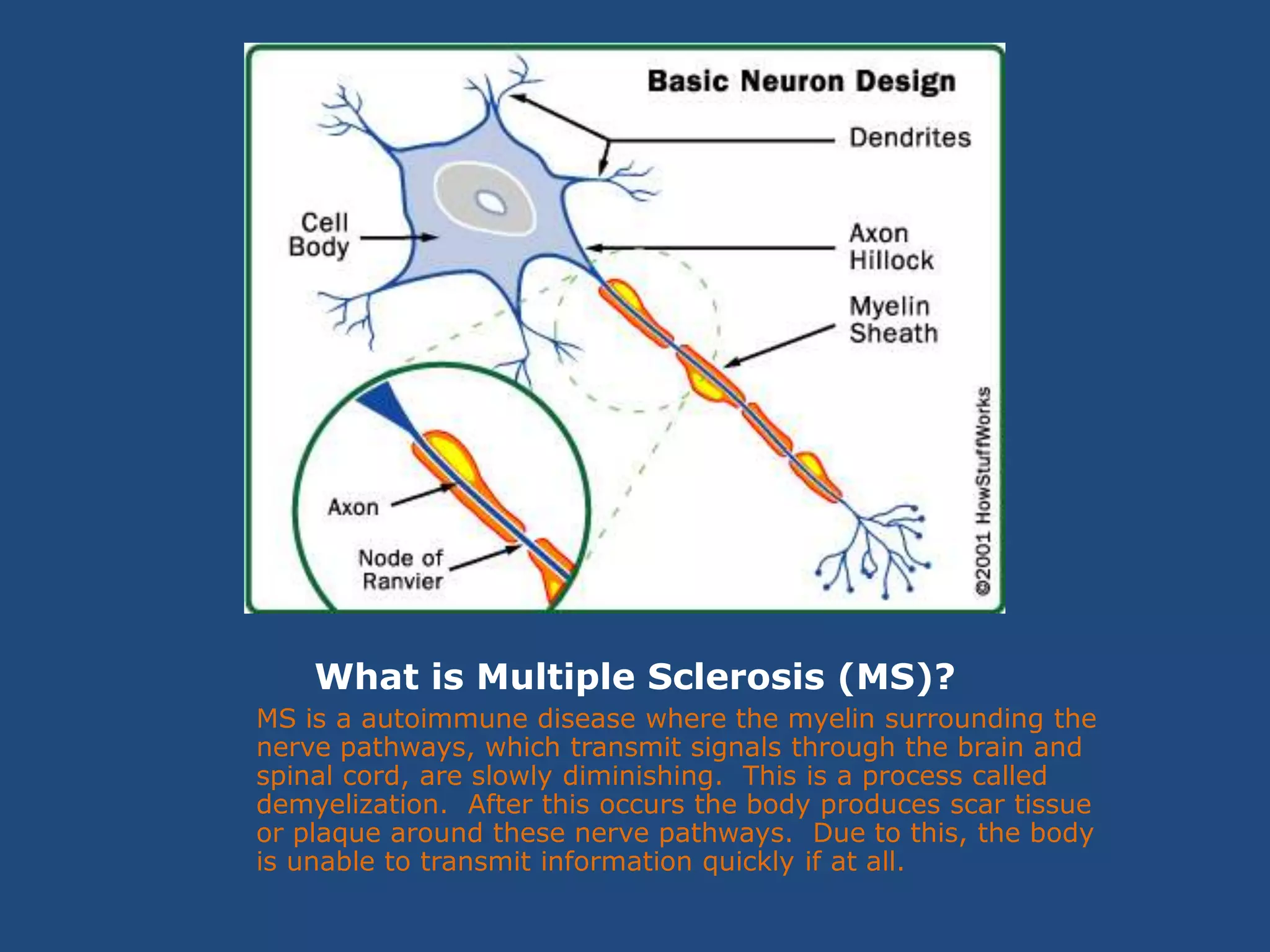 Multiple Sclerosis Powerpoint | PPTX | Brain and Nervous System Disorders | Diseases and Conditions