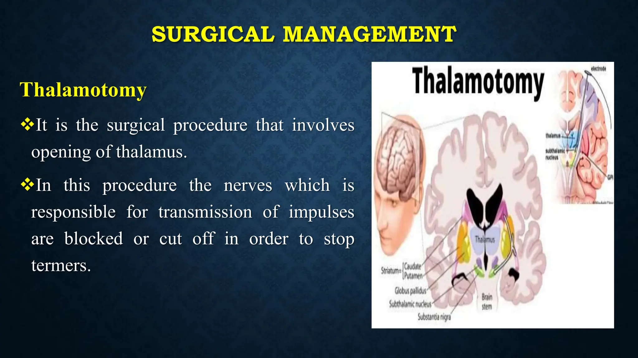 MULTIPLE SCLEROSIS PPT for nursing students.pptx