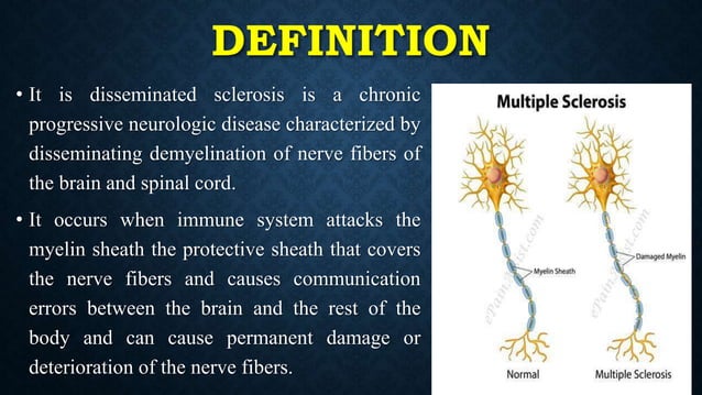 MULTIPLE SCLEROSIS PPT for nursing students.pptx | Brain and Nervous System Disorders | Diseases ...