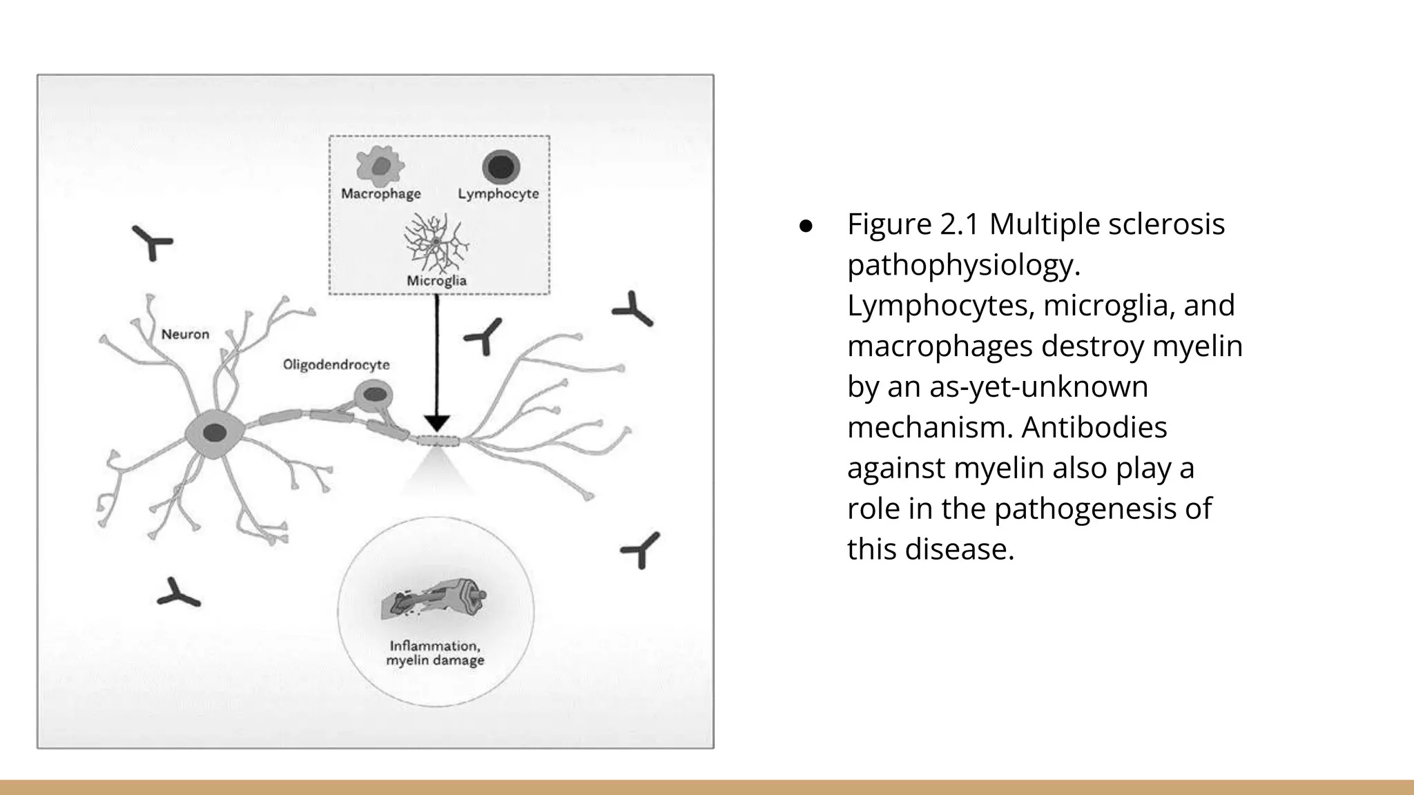 MULTIPLE SCLEROSIS slide.pptx